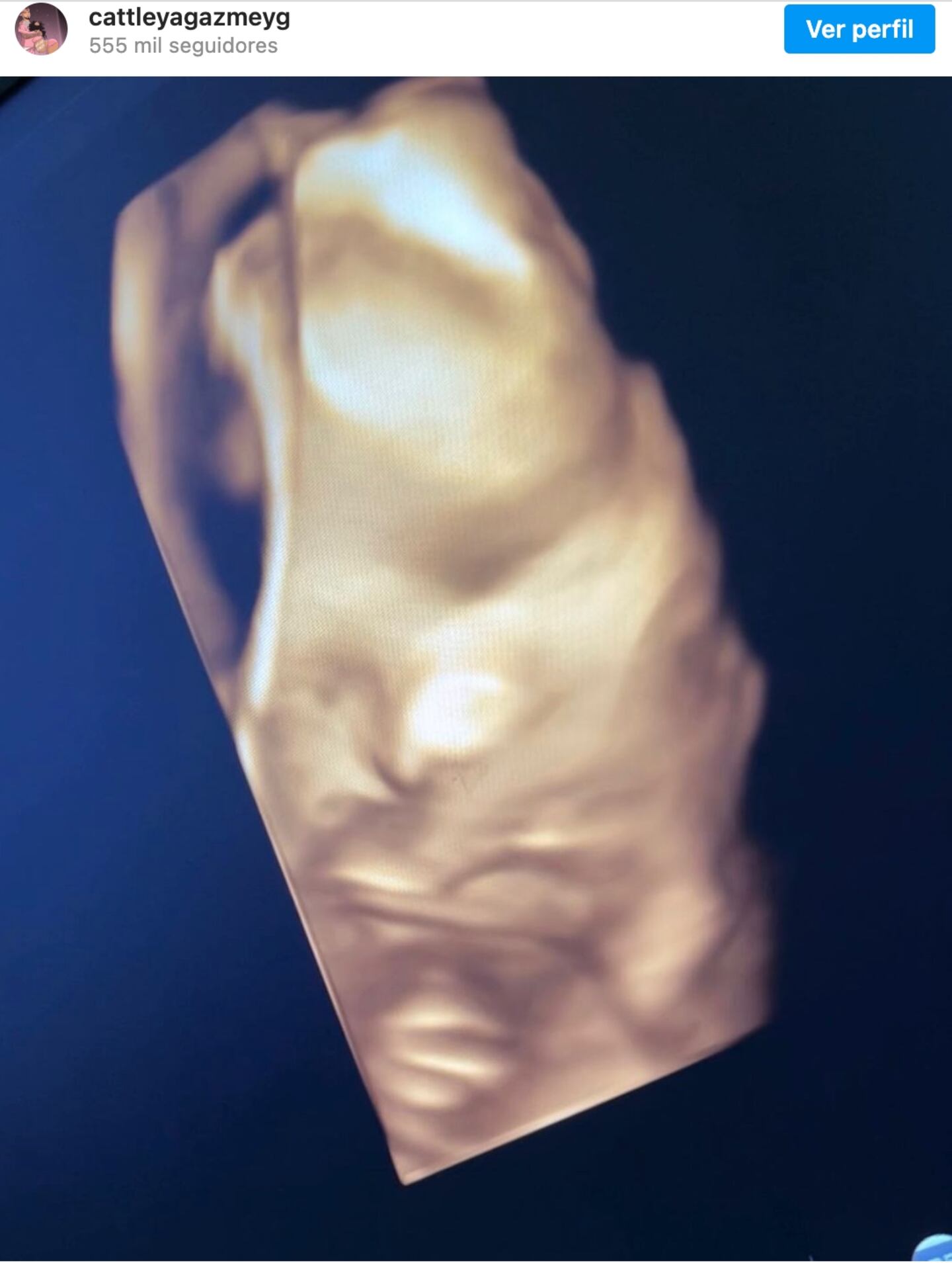 Yailin "La Más Viral" muestra el rostro de su bebé por primera vez ...